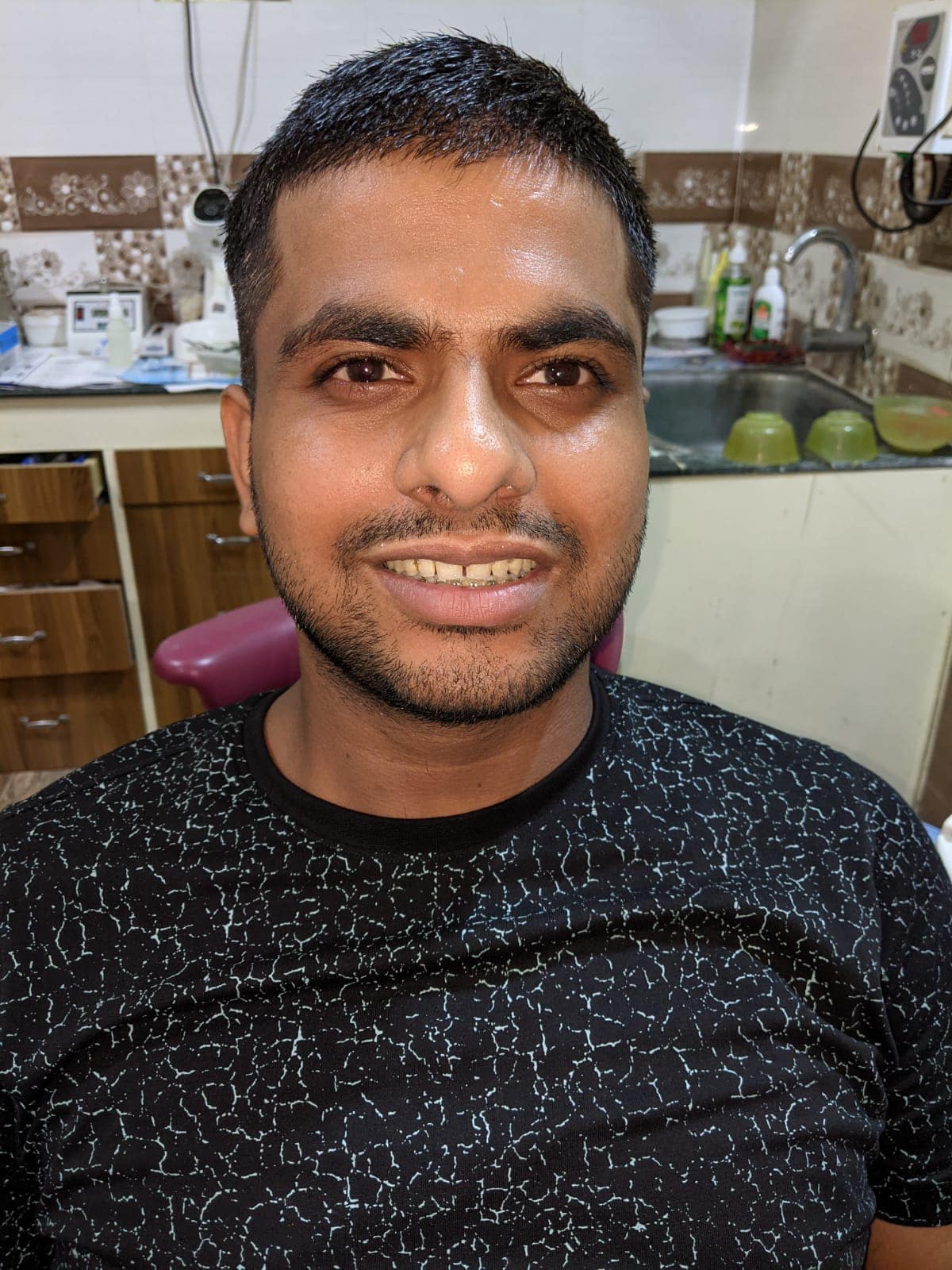 Before & After – Dr. Satpathy's Dental Excellence